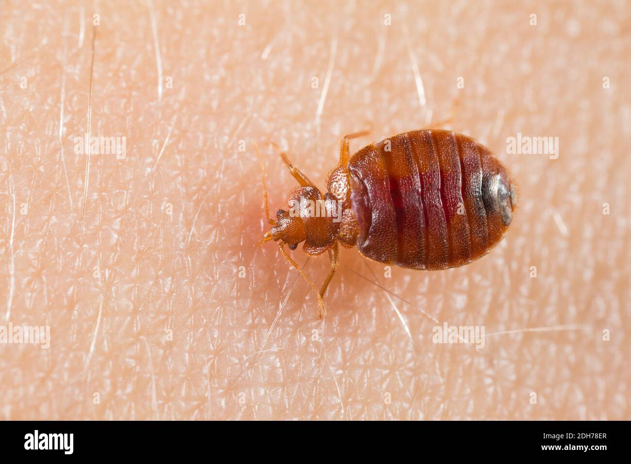 Common bed bug (Cimex lectularius) feeding on a human host Stock Photo ...