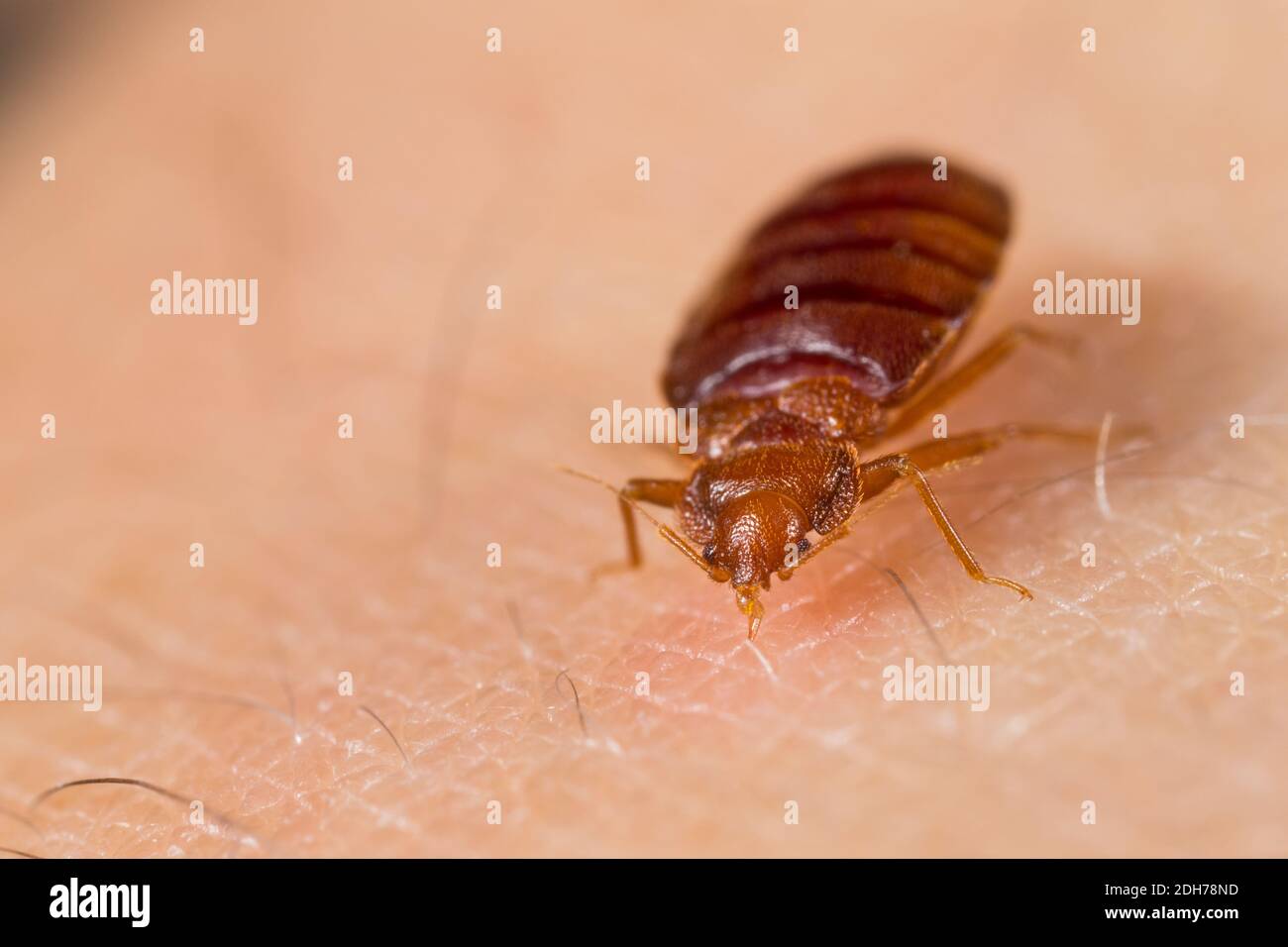 Common bed bug (Cimex lectularius) feeding on a human host Stock Photo ...
