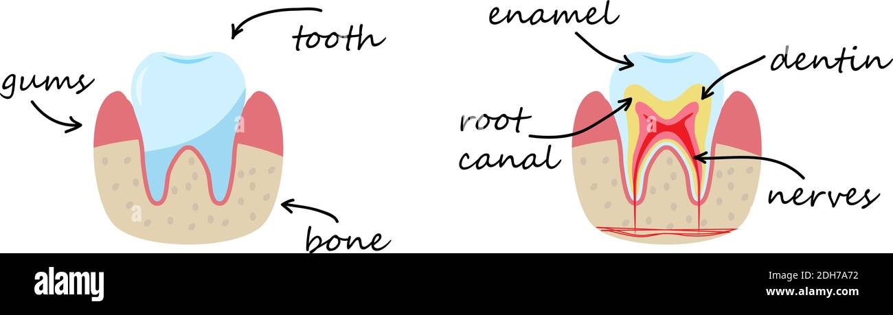 Illustration of the tooth device. Demonstration poster. Gums, bone ...