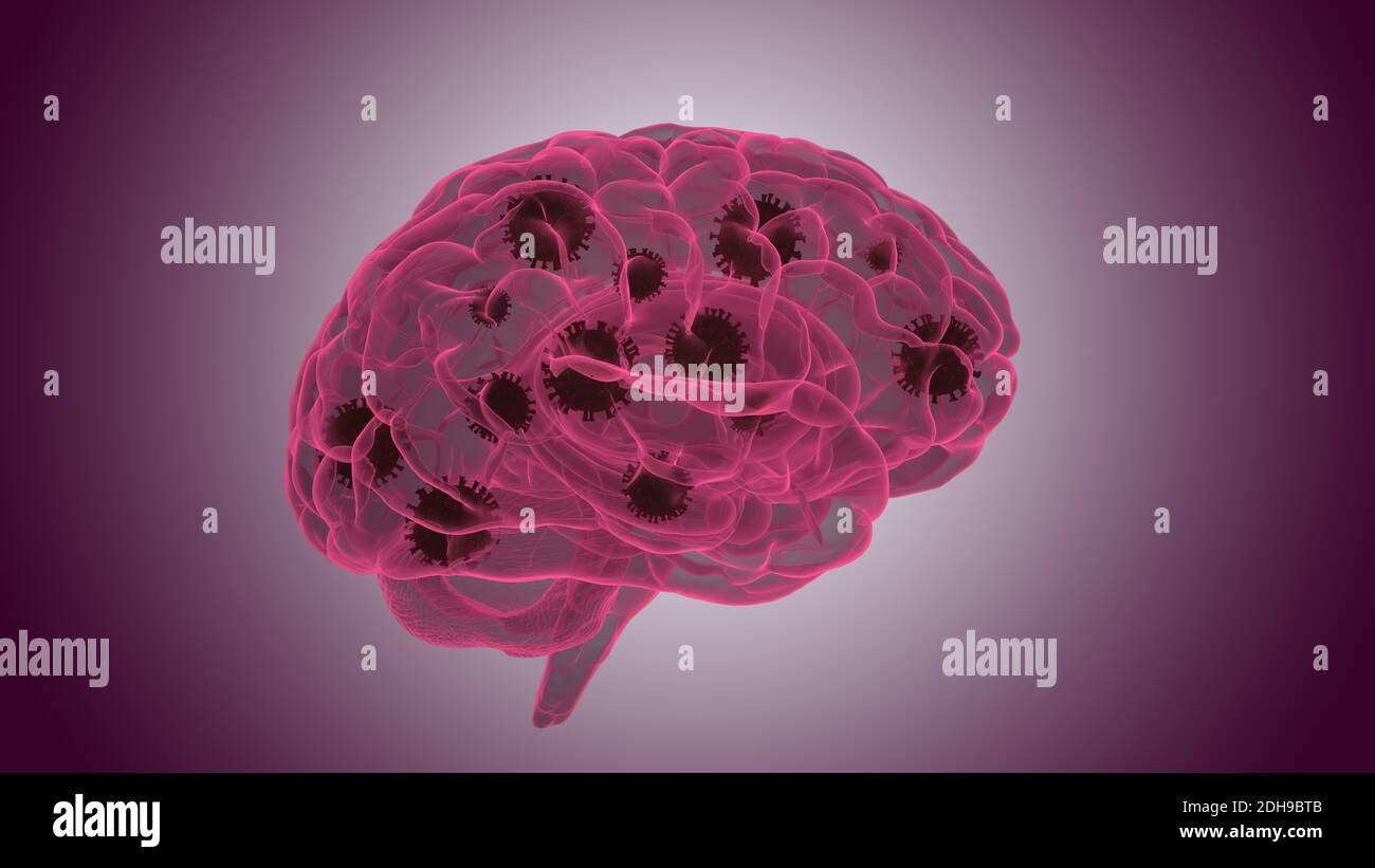 Coronavirus attacks the brain Stock Photo - Alamy