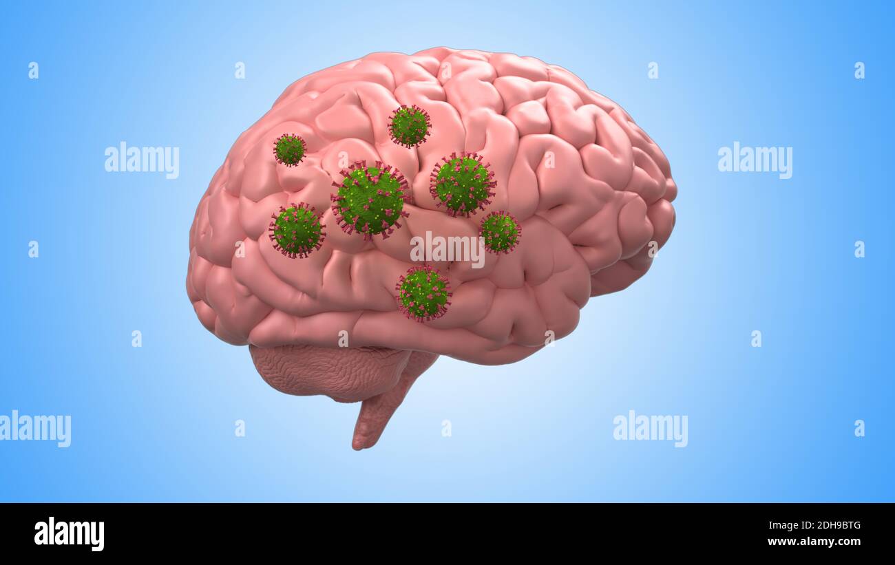 Infected brain hi-res stock photography and images - Alamy