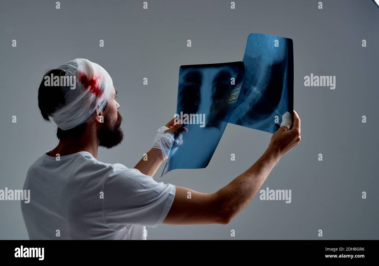 Normal shoulder x ray hi-res stock photography and images - Alamy