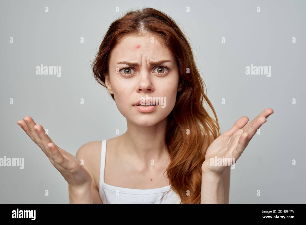 emotional woman pimples on forehead dermatology dissatisfaction skin ...