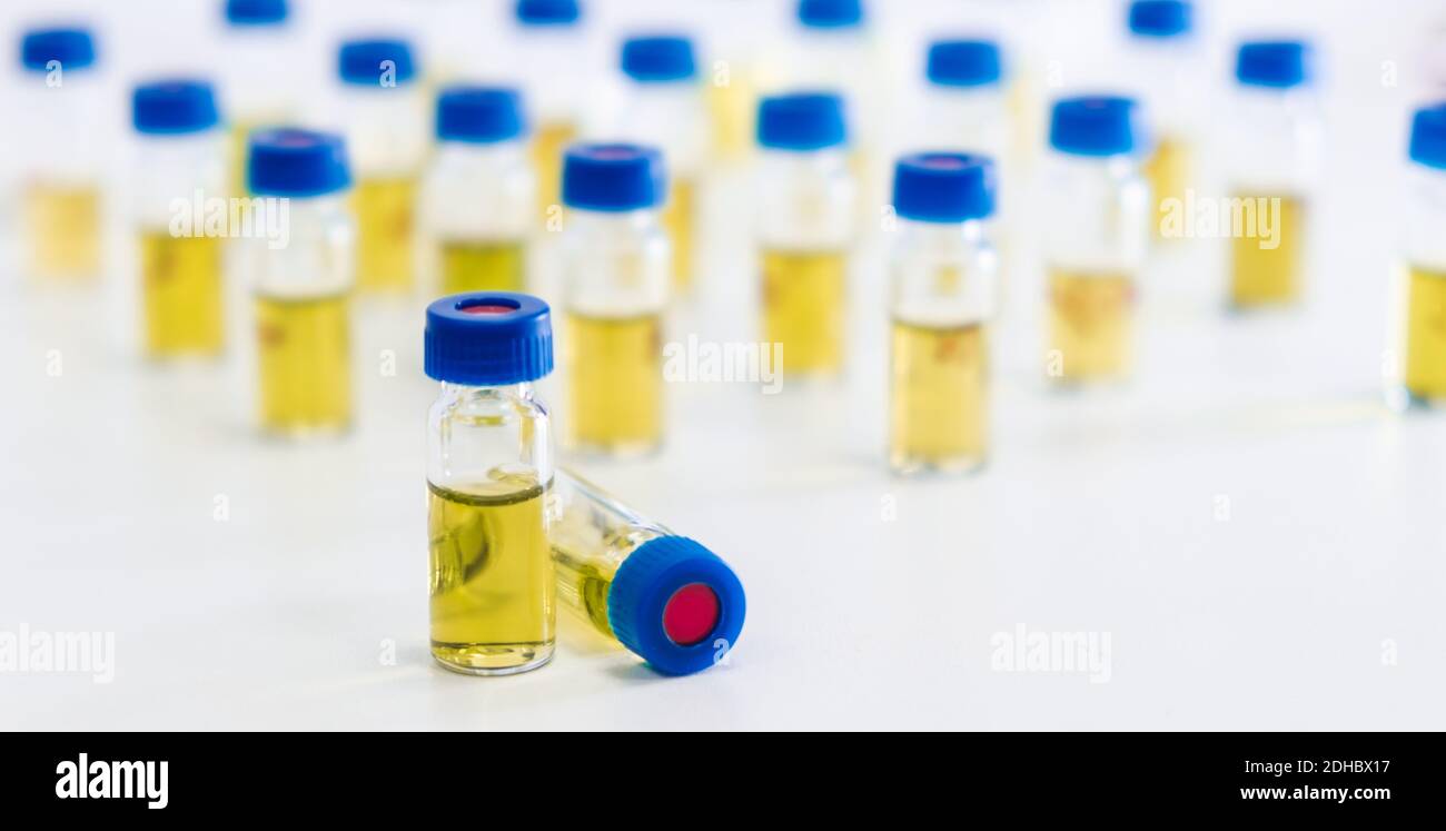 Test tubes with urine sample for HPLC analysis in the laboratory Stock ...