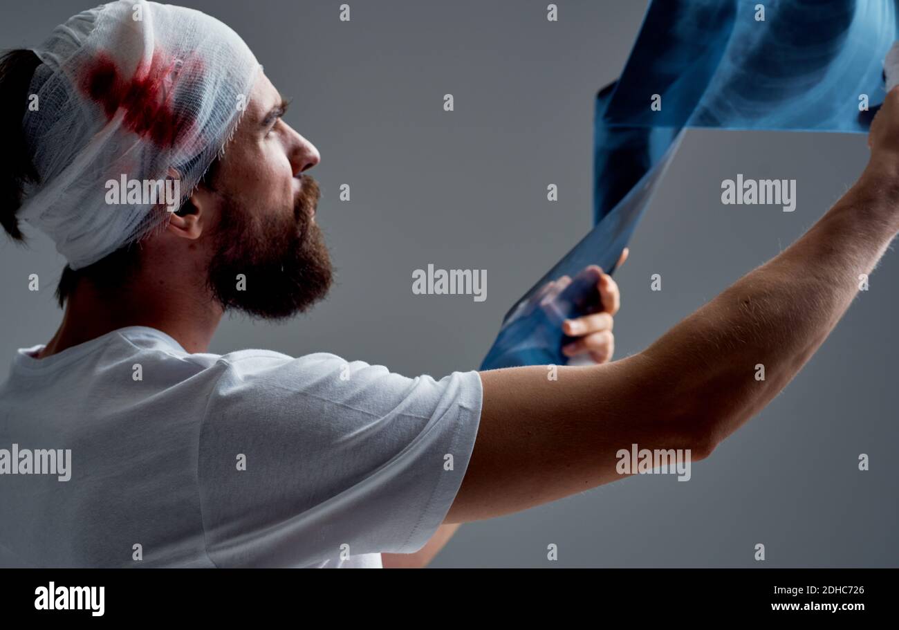 Normal shoulder x ray hi-res stock photography and images - Alamy