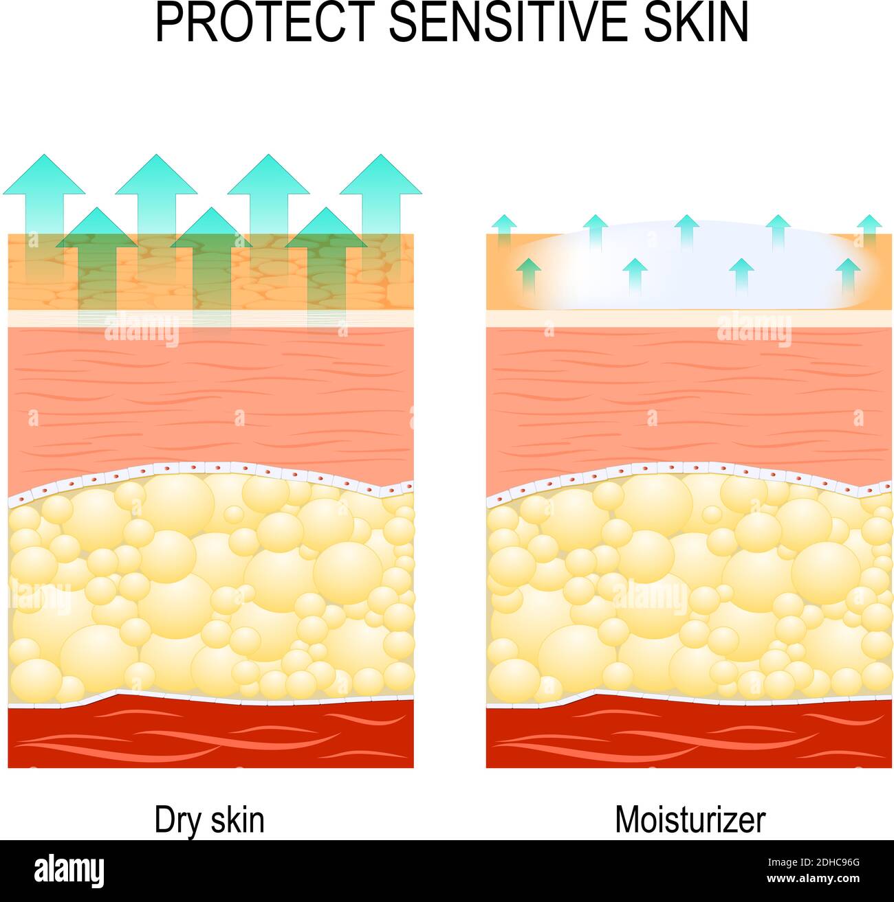 Dry skins Stock Vector Images - Alamy