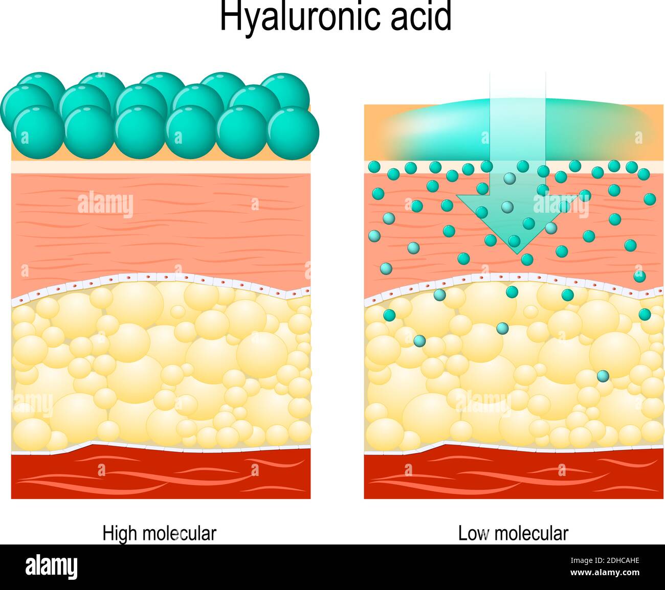Hyaluronic acid. Hyaluronic acid in skin-care products. Low molecular ...