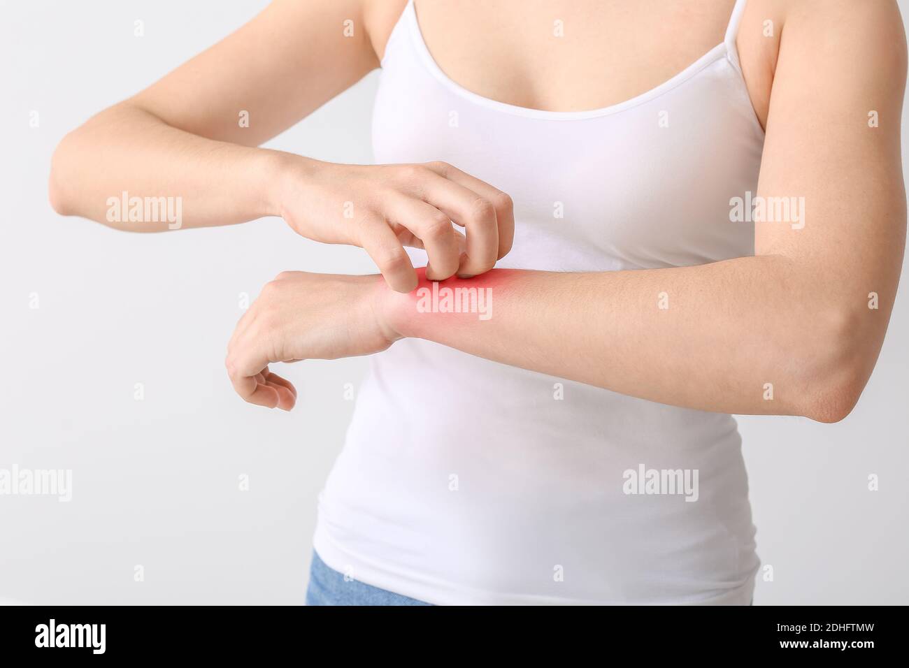 Young allergic woman scratching her skin against light background Stock ...