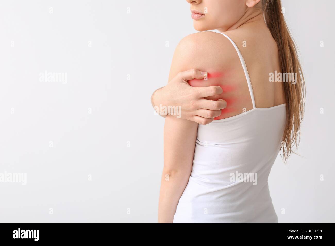 Young allergic woman scratching her skin against light background Stock ...
