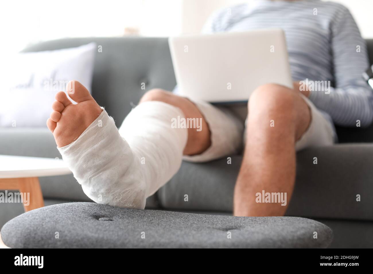 Broken leg hi-res stock photography and images - Alamy