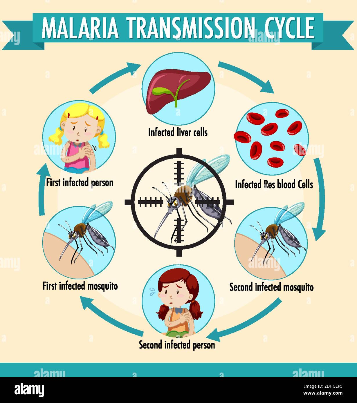 Malaria transmission cycle information infographic illustration Stock ...