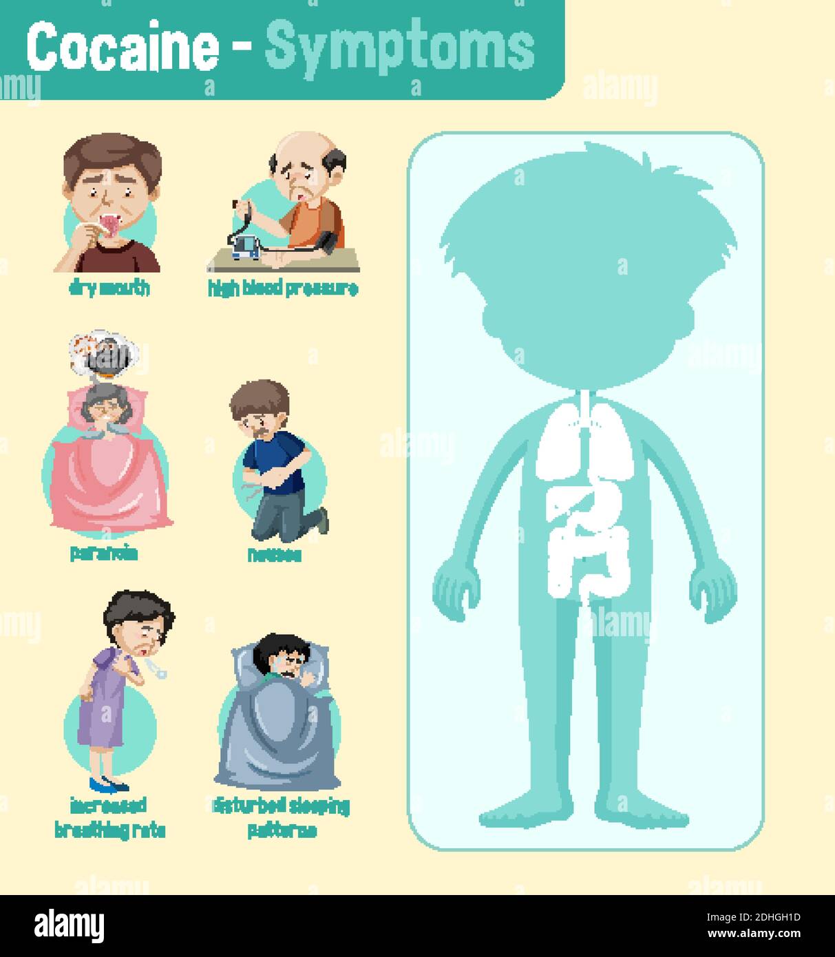 Health effects of Cocaine Infographic illustration Stock Vector Image ...