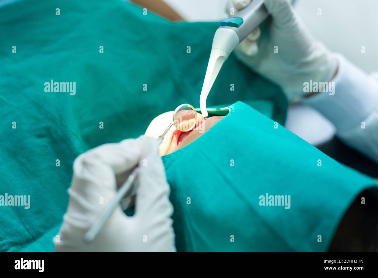 Close up hand dentist check teeth milk tooth of Child is sitting in a ...