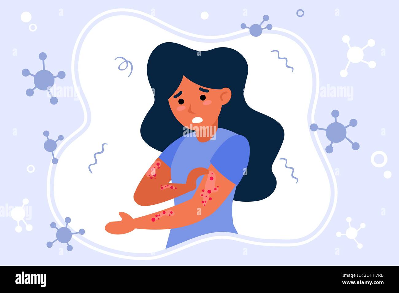 Urticaria Vector Vectors High Resolution Stock Photography and Images ...