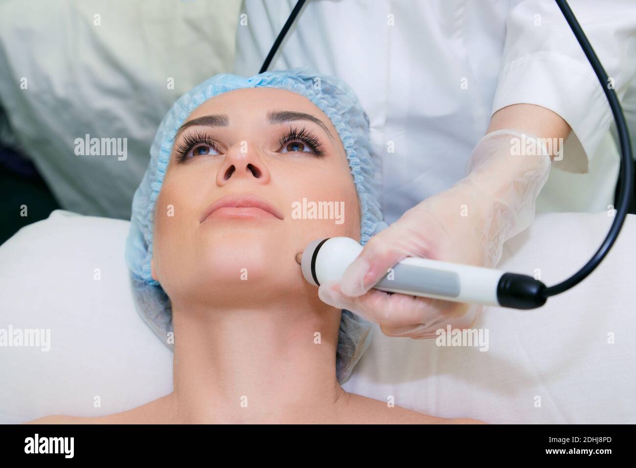 A young woman is lying on the RF-lifting procedure for face skin ...