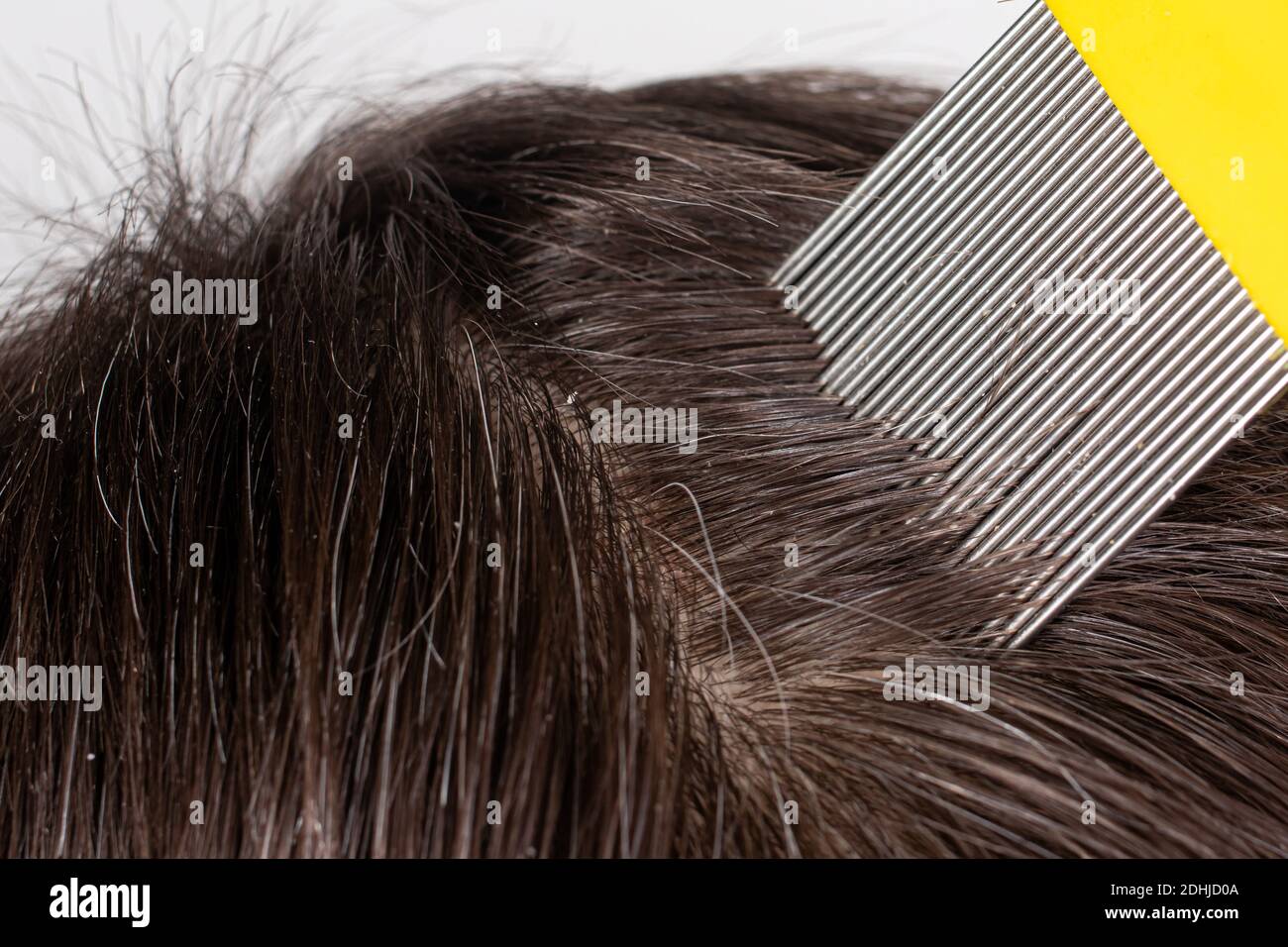 A brunette woman with pediculosis cleans her hair from lice and nits with a comb with small ...