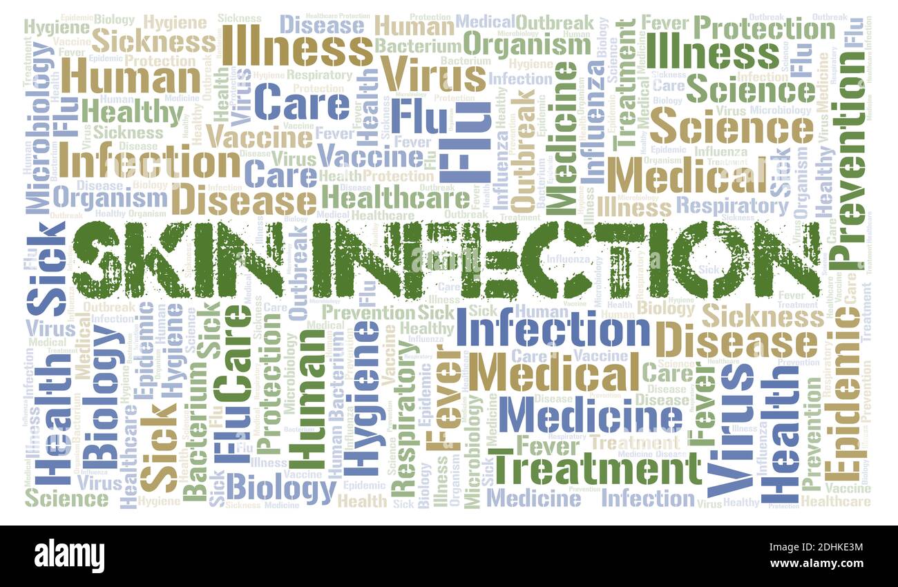 Skin Infection typography word cloud create with text only Stock Photo ...
