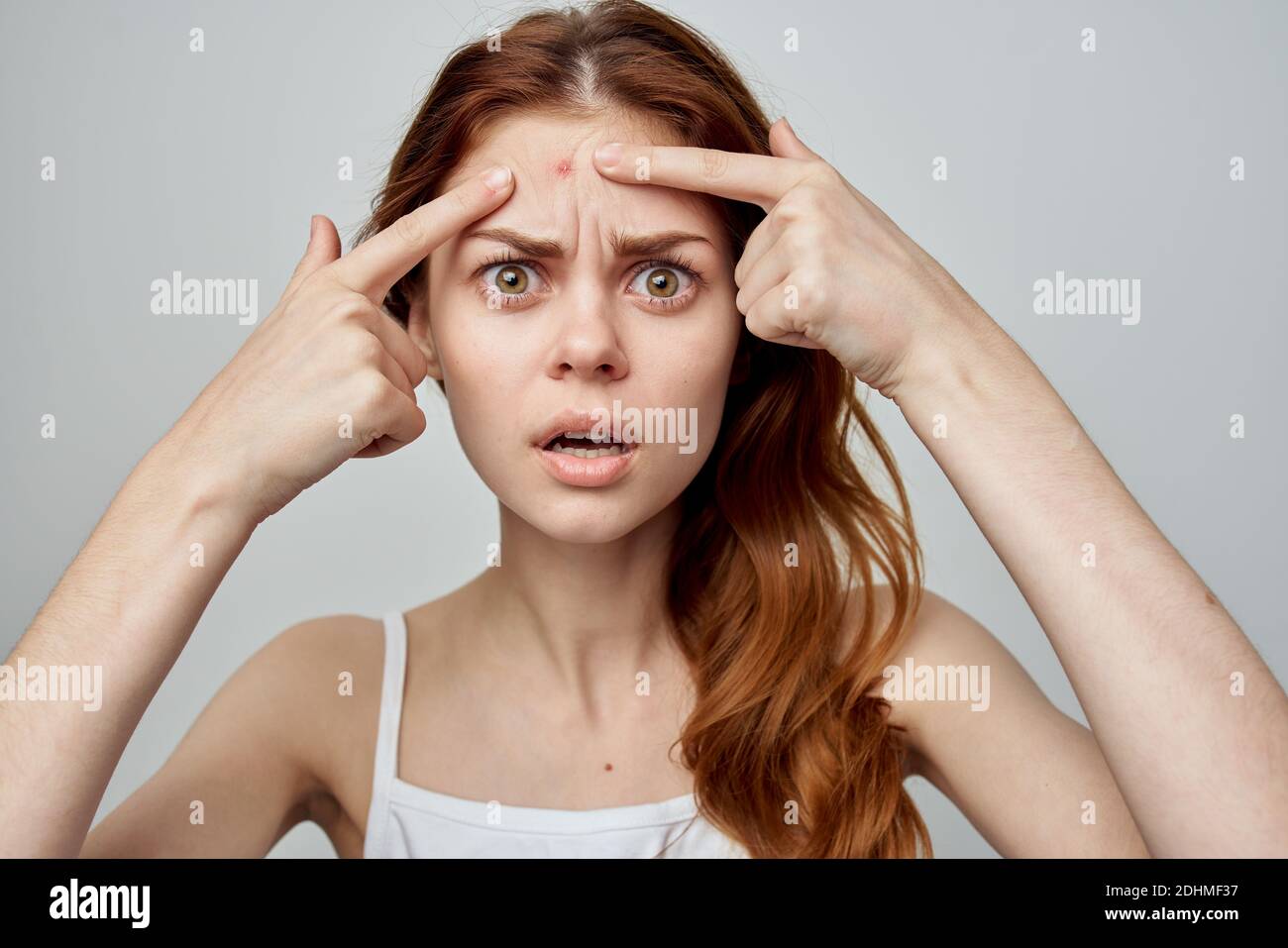 emotional woman pimples on forehead dermatology dissatisfaction skin ...