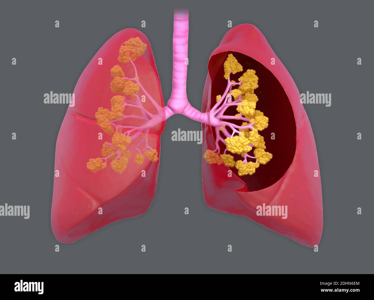 Illustration of human lungs. The lungs transport oxygen into the body ...