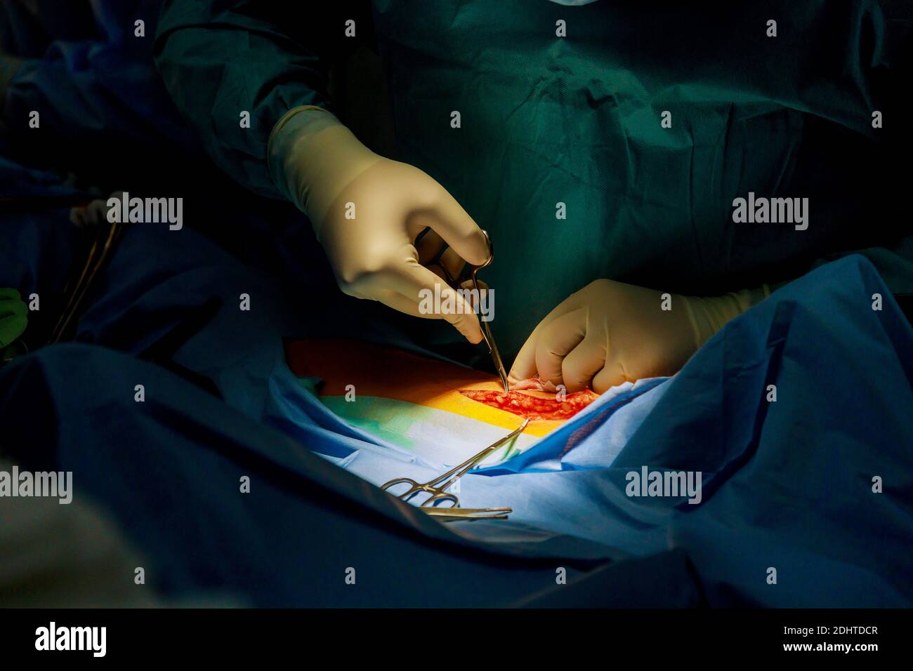 Patient with a cutting our incision a little deeper human leg with ...