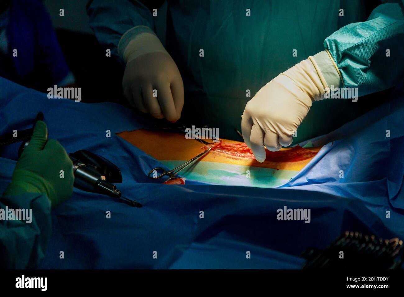 Surgeon using scalpel cut skin hi-res stock photography and images - Alamy