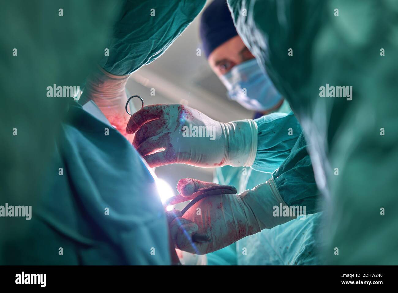 Physicians in Surgery looking down at patient Stock Photo - Alamy