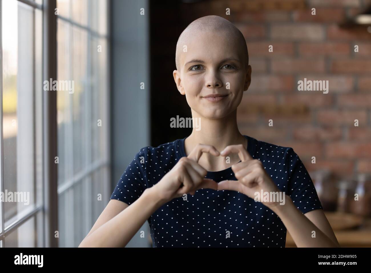 Head shot portrait hairless sick woman showing heart gesture Stock ...