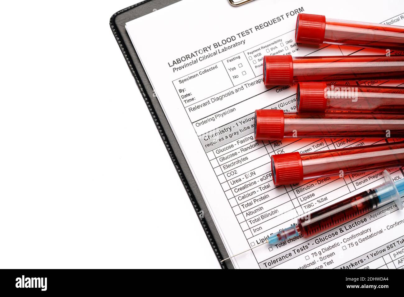 Clipboard with paper blank form with blood test tubes on white ...