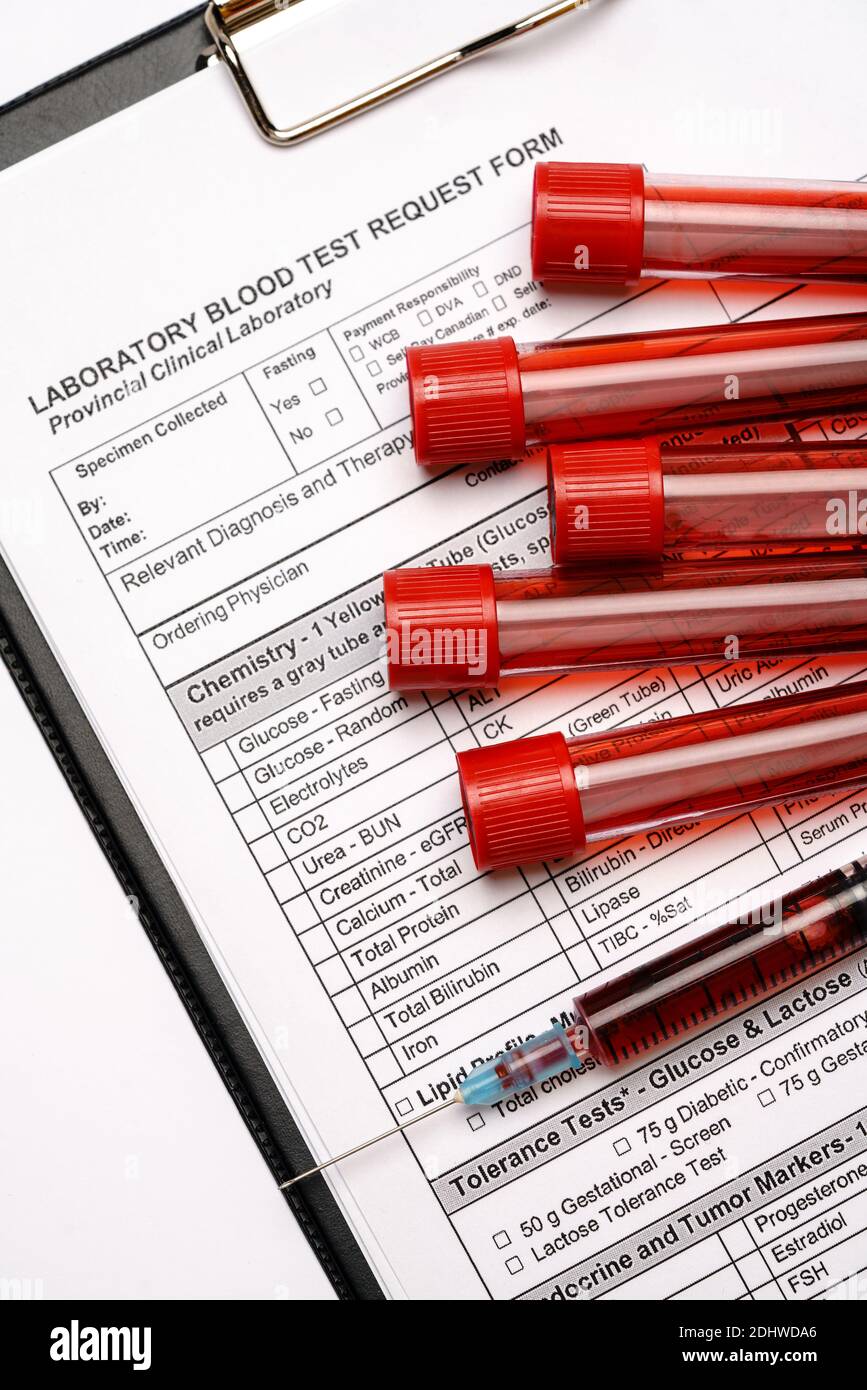 Clipboard with paper blank form with blood test tubes on white ...