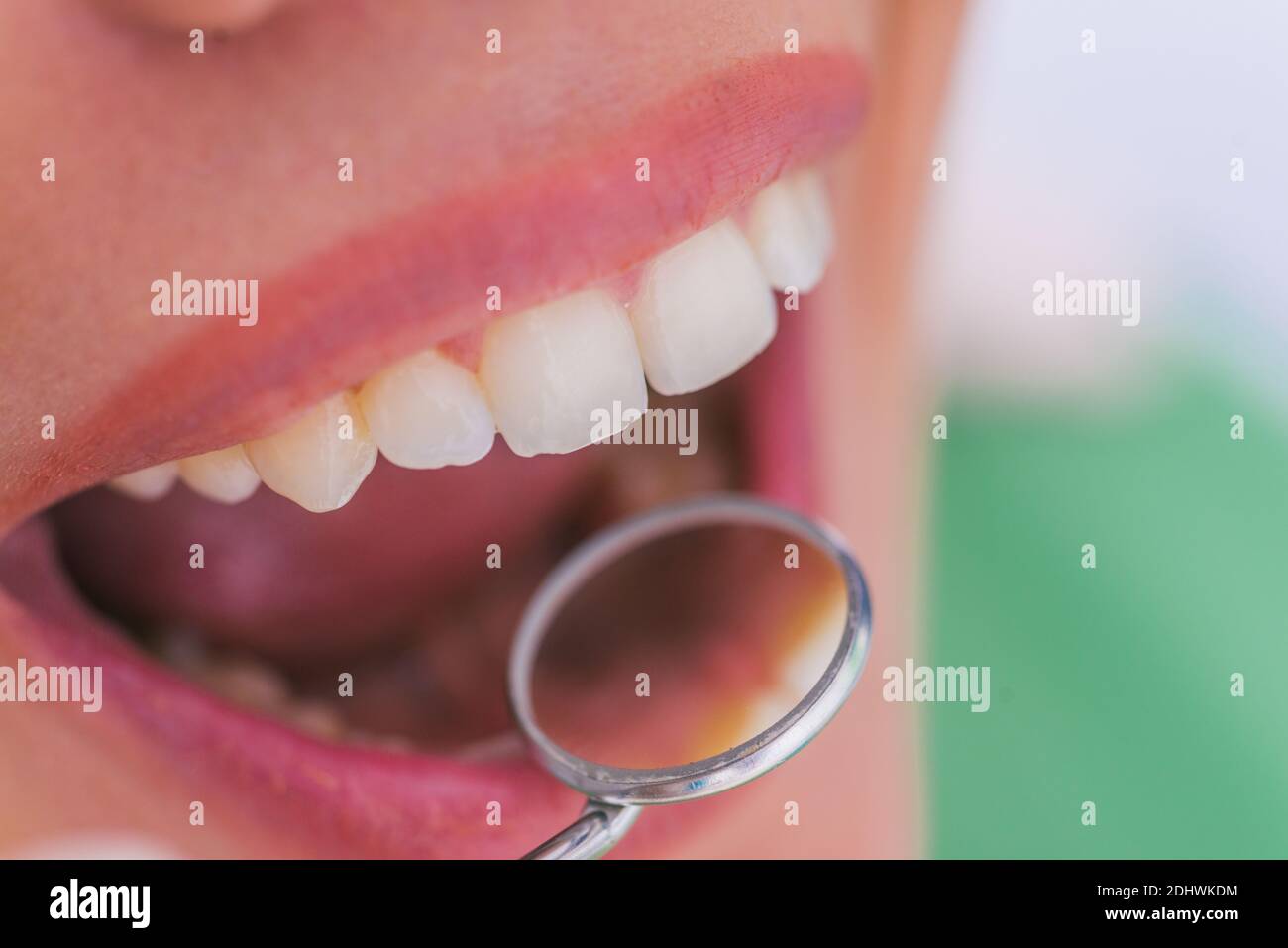 Closeup of a female patient with an open mouth during oral checkup at ...