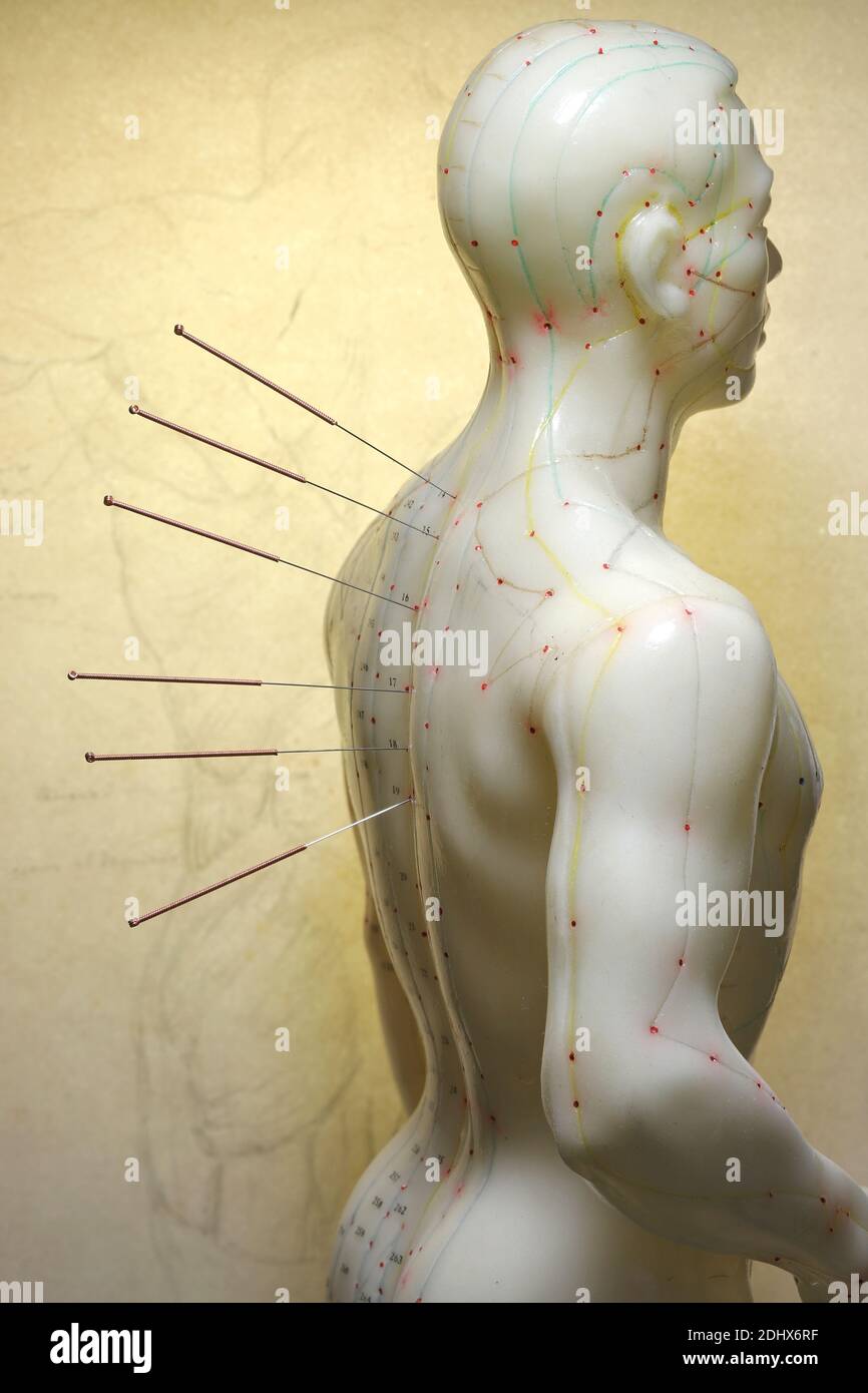 male acupuncture model with needles in the backbone Stock Photo - Alamy