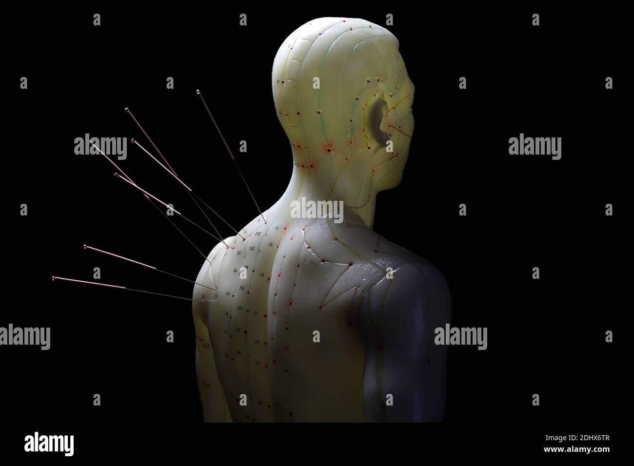 male acupuncture model with needles in the left shoulder against black ...