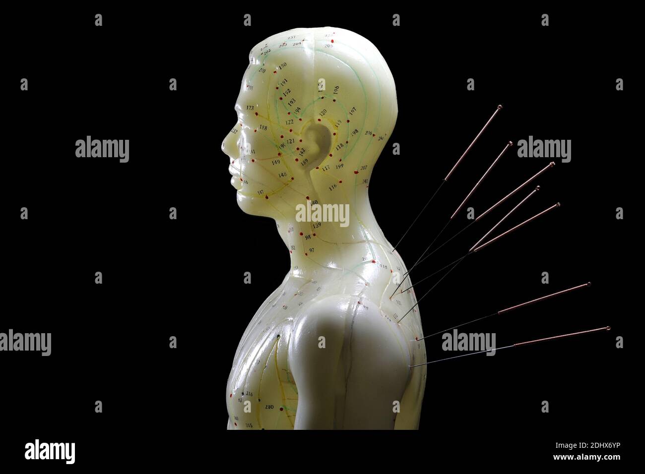 male acupuncture model with needles in the left shoulder against black ...