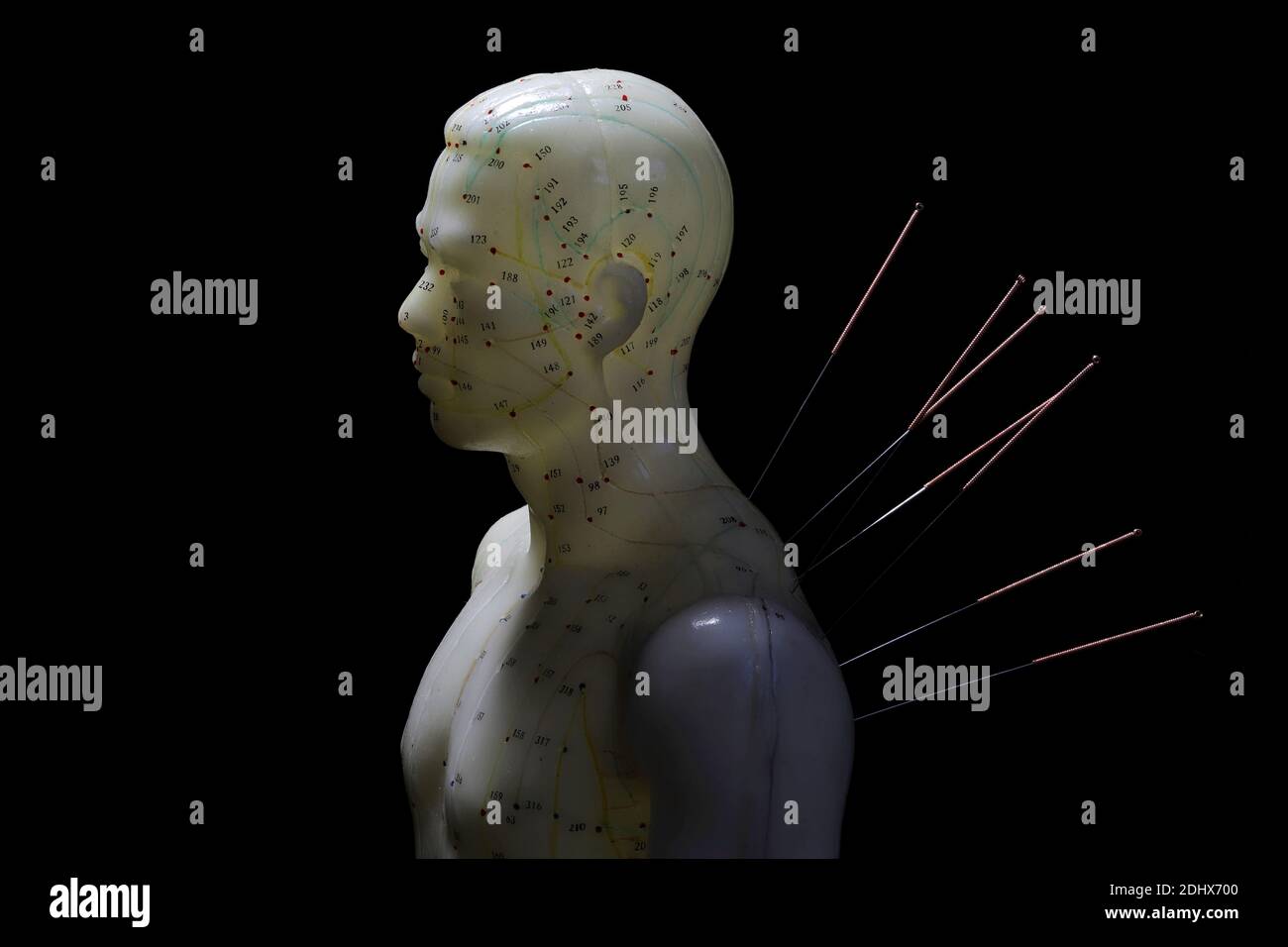 male acupuncture model with needles in the left shoulder against black ...