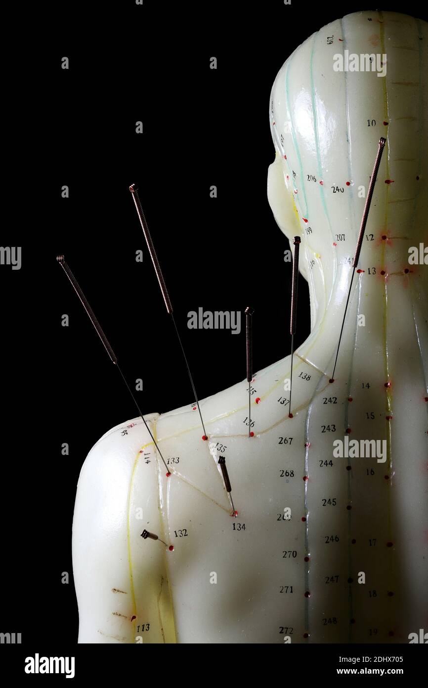 male acupuncture model with needles in the left shoulder against black ...