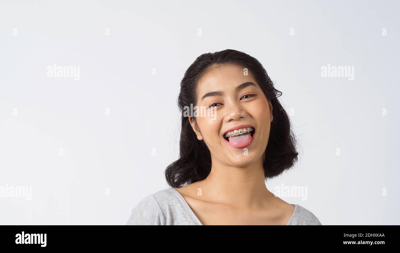 Dental Brace Beautiful Girl Smiling Looking On A Camera White Teeth