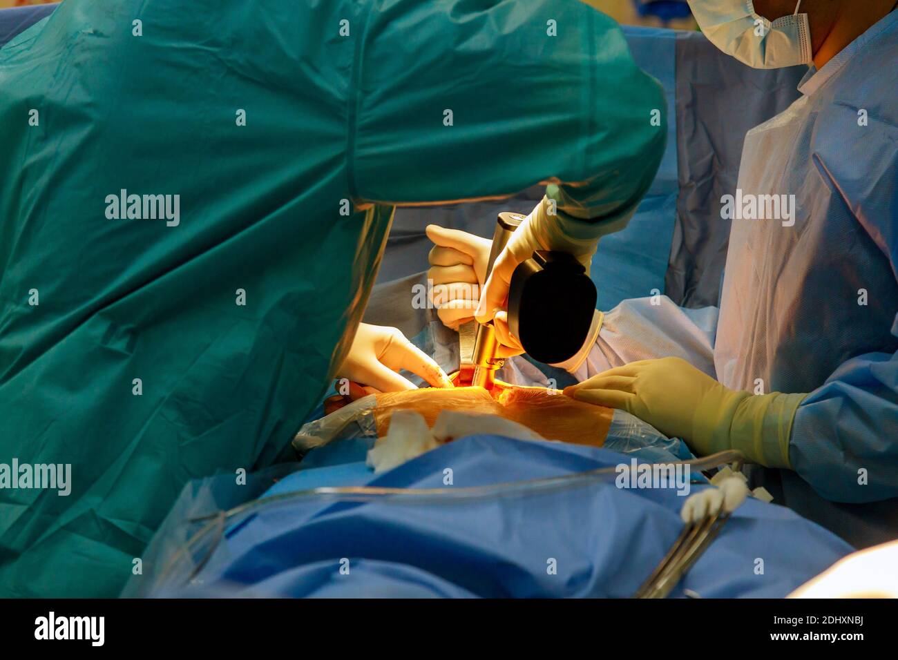 Surgeon themselves inside the wound with surgical instrument during the ...