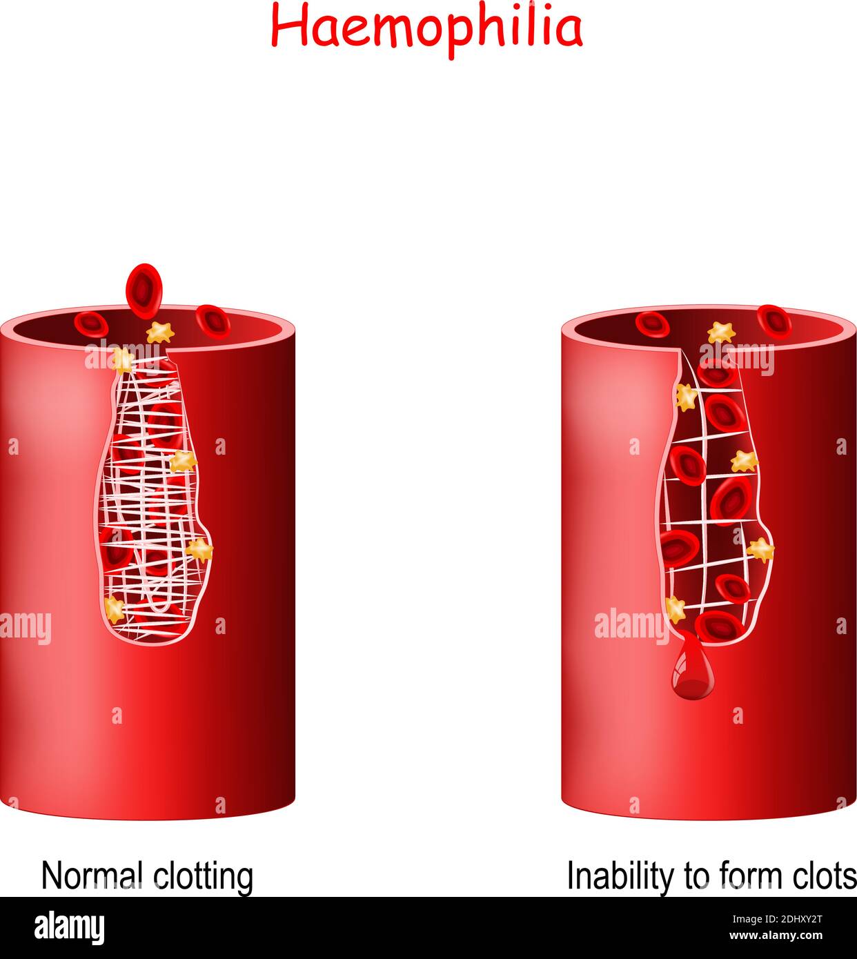 Blood coagulation factor Stock Vector Images - Alamy
