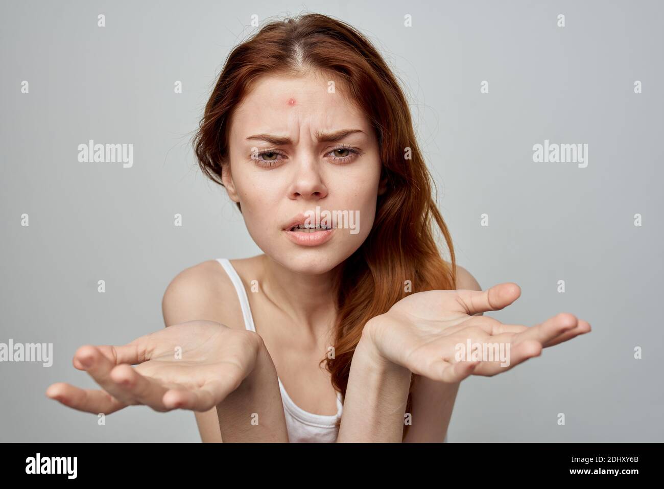 emotional woman pimples on forehead dermatology dissatisfaction skin ...