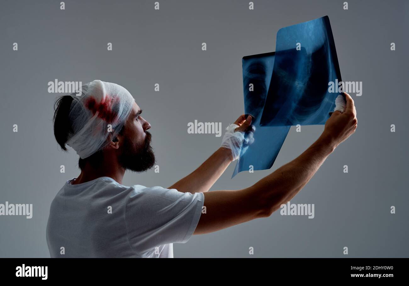 Normal shoulder x ray hi-res stock photography and images - Alamy