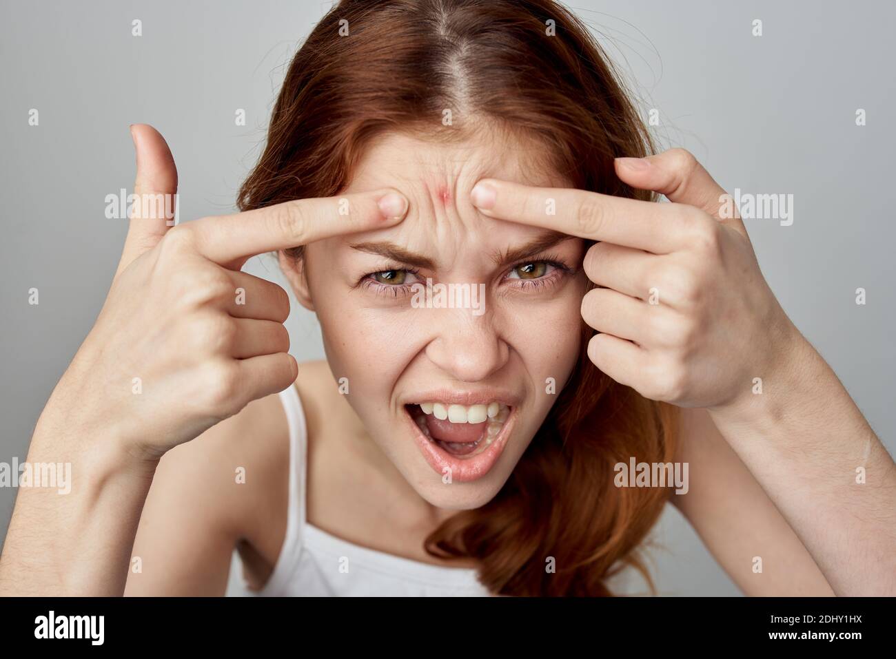 woman squeezes pimple on her forehead skin problems cosmetology Stock ...