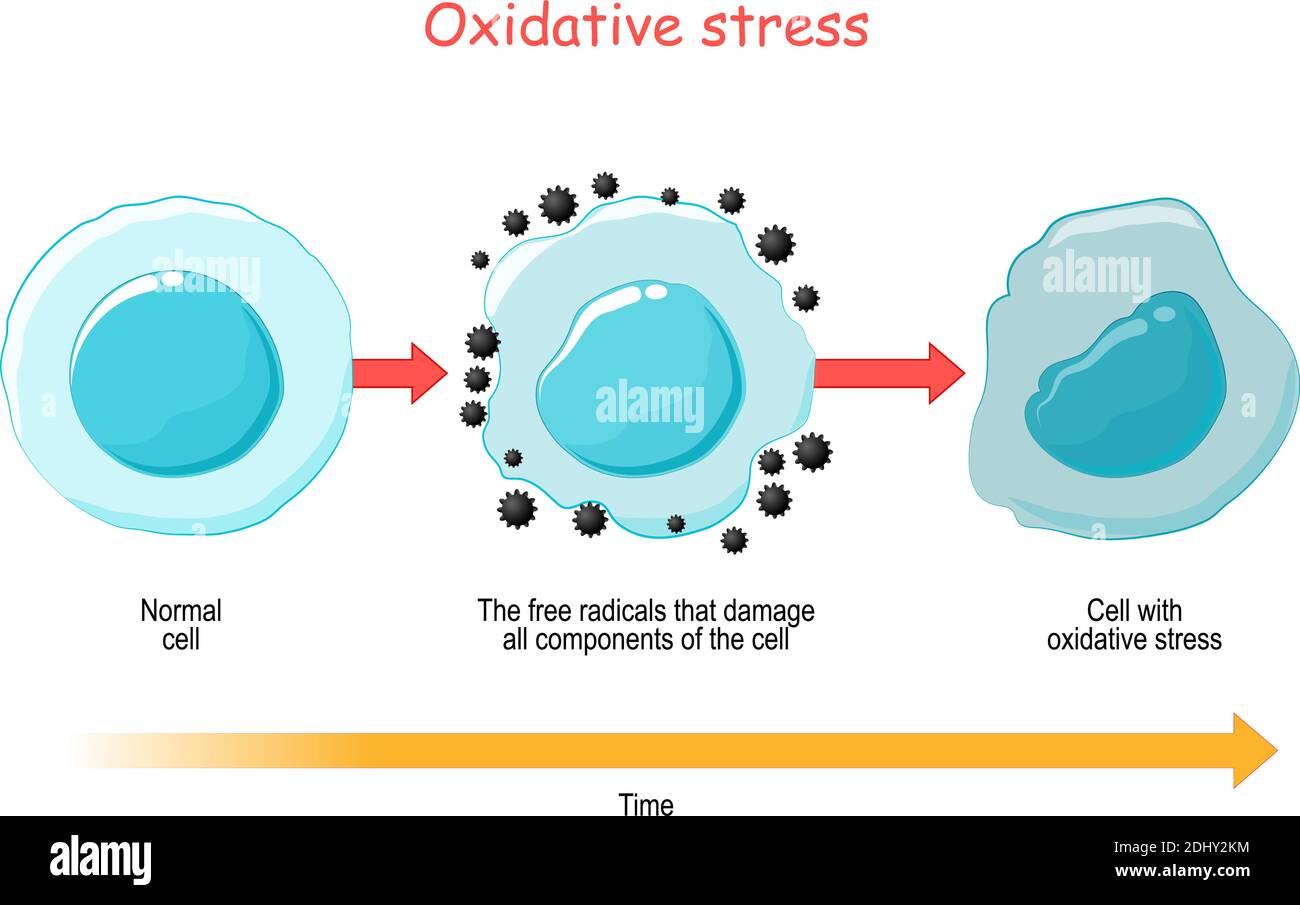 Oxidative Stress. Vector diagram Cell with free radicals. illustration ... Oxidative Stress. Vector diagram Cell with free radicals. illustration ...