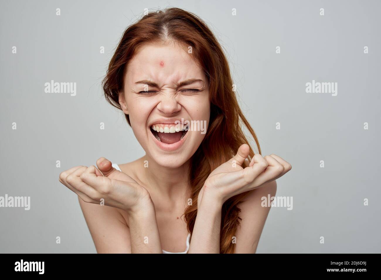 emotional woman pimples on forehead dermatology dissatisfaction skin ...