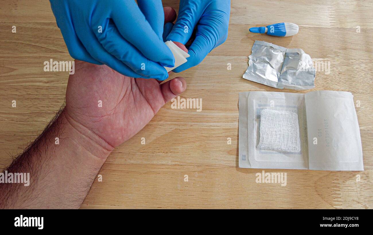 A medical personnel wearing gloves is wiping the finger tip of a ...