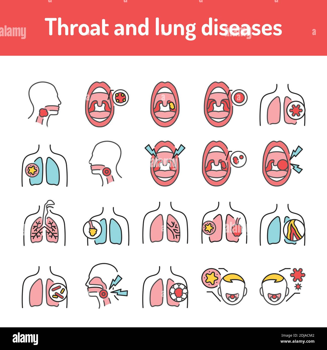Throat and lung diseases color line icons set. Pictograms for web page ...