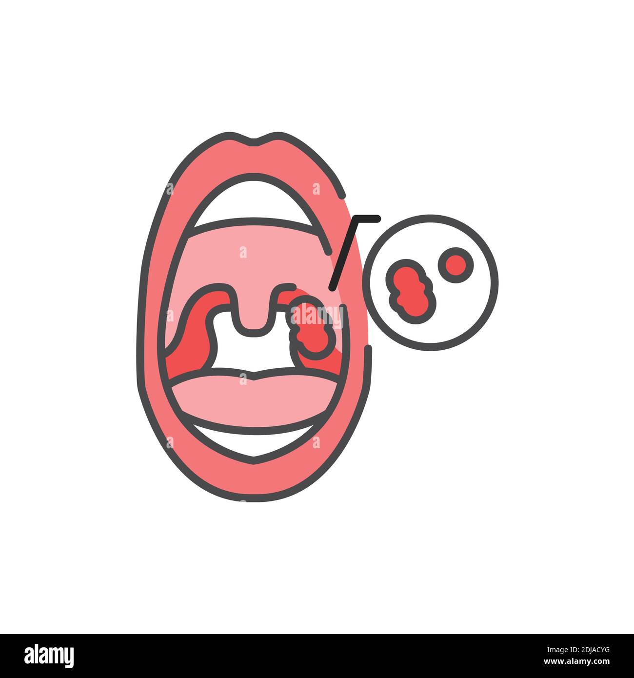 Adenoids hi-res stock photography and images - Alamy