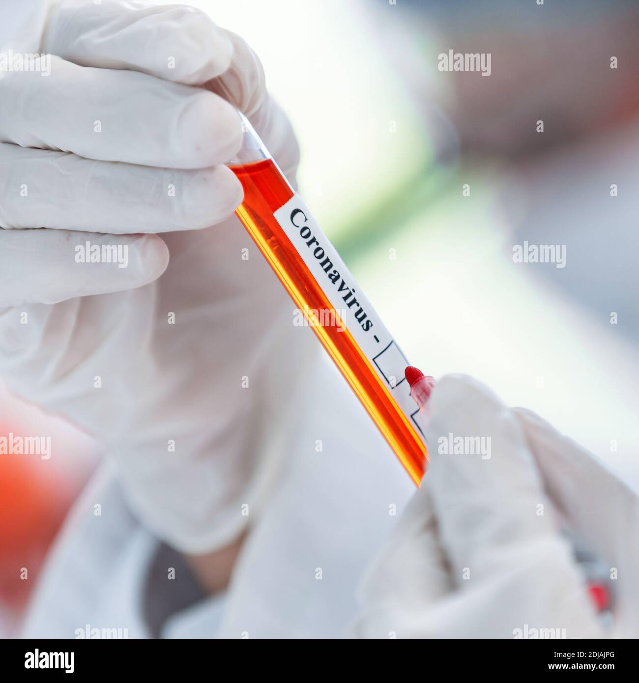 background image marking the tube with the tested test Stock Photo - Alamy