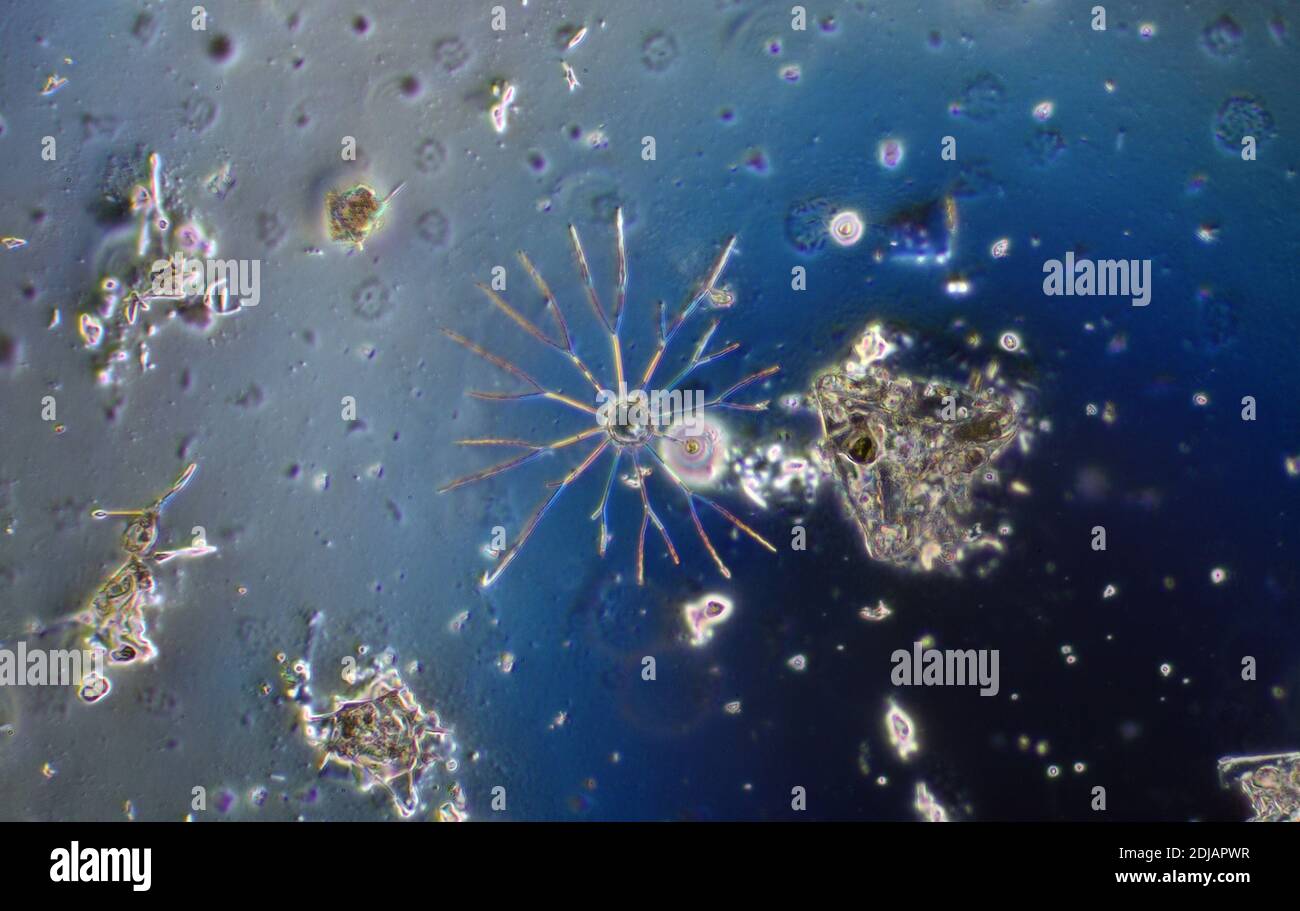 Bacteriastrum diatom, Hong Kong, China Stock Photo - Alamy