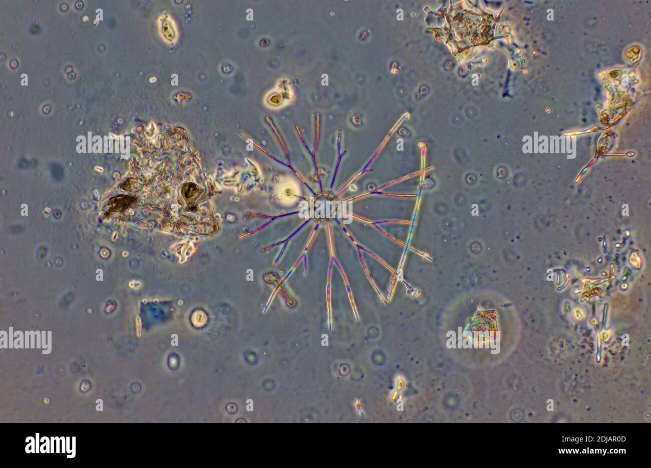 Bacteriastrum diatom, Hong Kong, China Stock Photo - Alamy