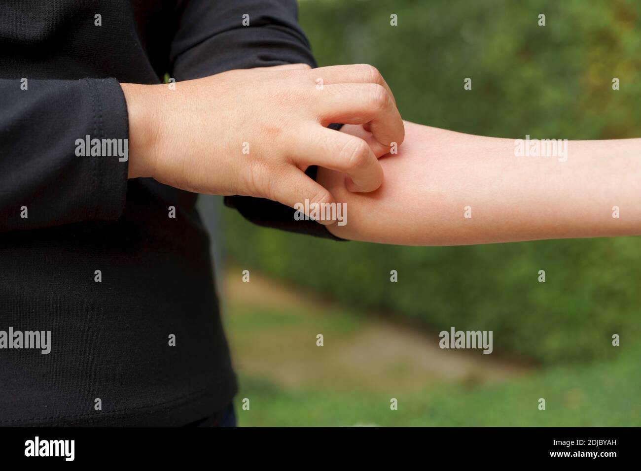 Skin Forearm High Resolution Stock Photography and Images - Alamy